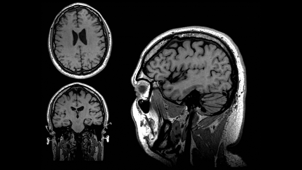 MediSys eVarsity | Paediatric imaging - MediSys eVarsity